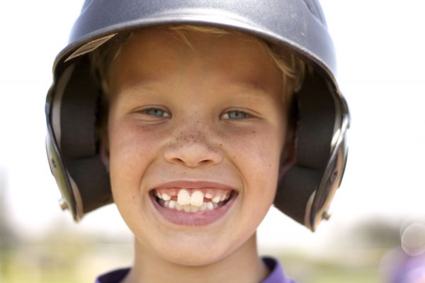 Buck Tooth and the Diverse Treatment Options – Dr. Gibberman